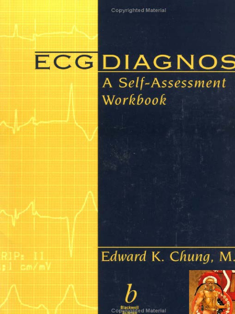 ECG Diagnosis - A Self-Assesment Workbook (Edward Chung) | PDF