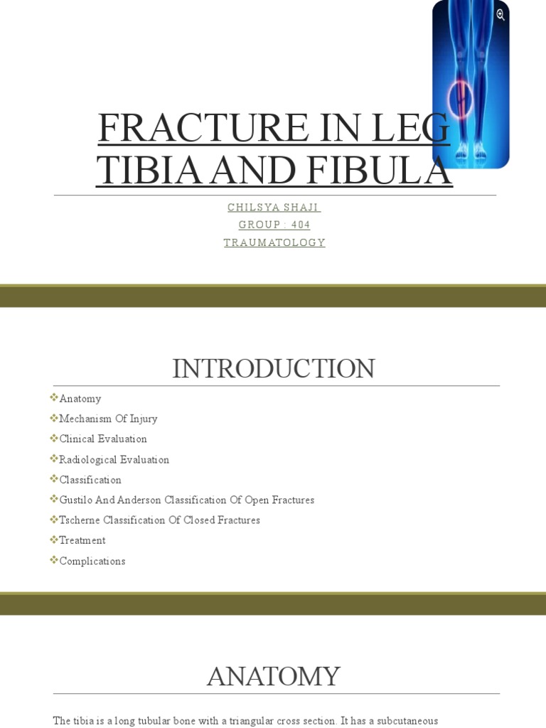 Tibia-Fibula Fracture Overview | PDF | Knee | Ankle