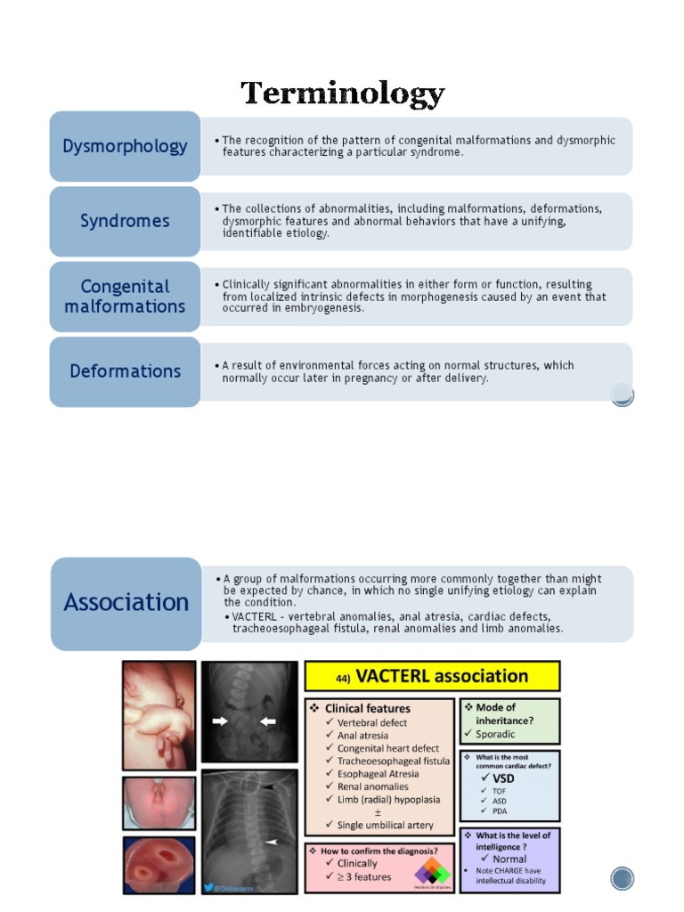 The Approach To Dysmorphic Child | PDF | Medicine | Medical Specialties