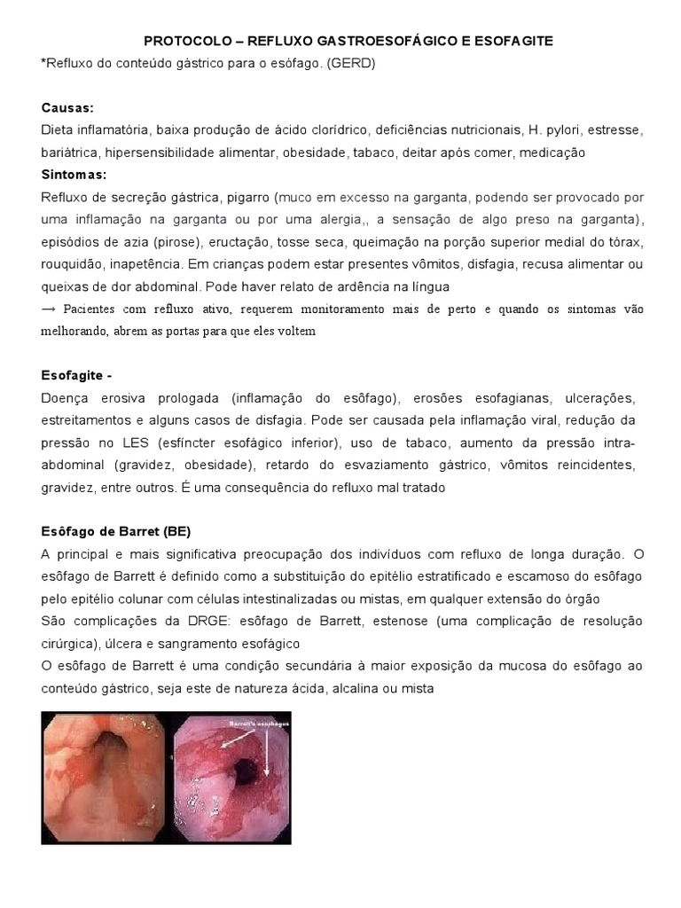 Protocolo de Tratamento para Refluxo e Esofagite | PDF | Doença do ...