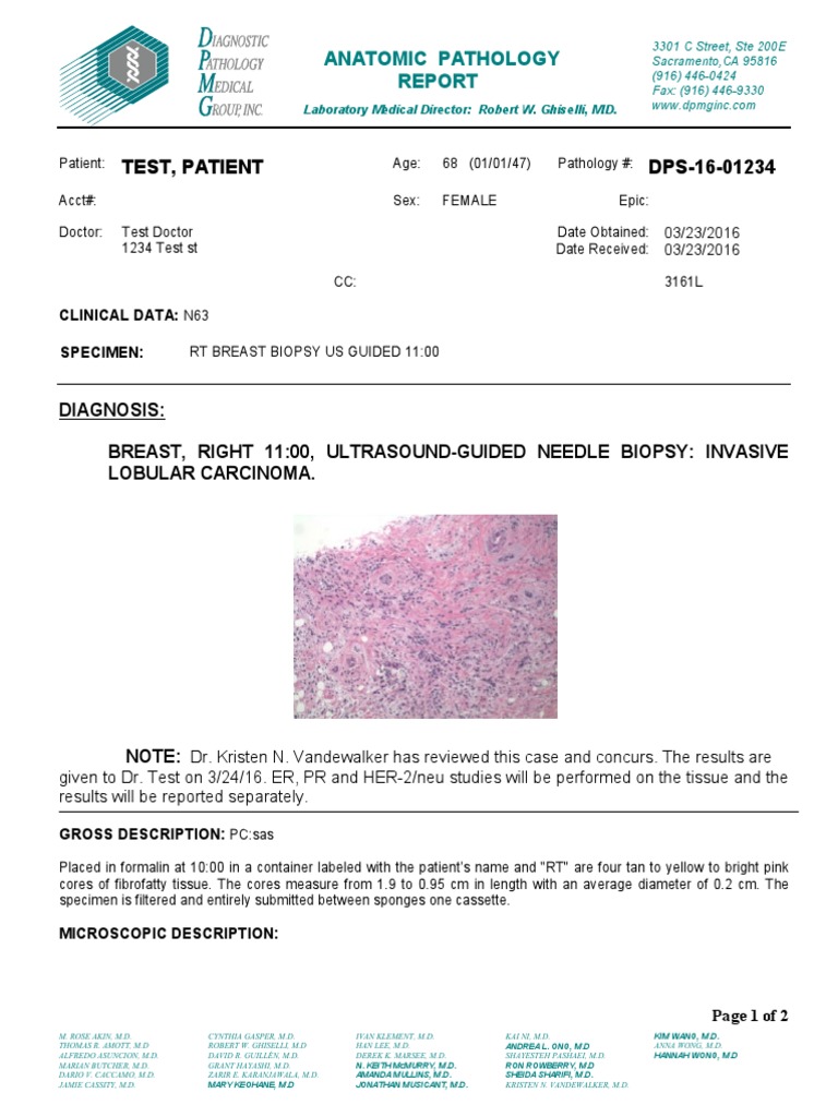 Breast Cancer Biopsy Report Summary | PDF | Pathology | Biopsy