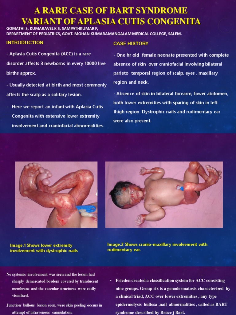 A Rare Case of Aplasia Cutis Congenita | PDF | Animal Diseases ...