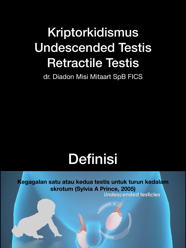 Kriptorkidismus Retractile Testis | PDF