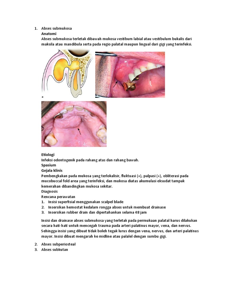 Abses Submukosa | PDF