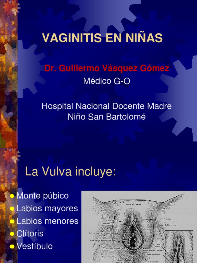 Vulvovaginitis en Niñas: Causas y Tratamiento | PDF