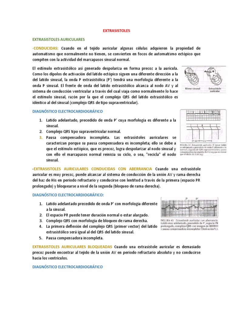 EXTRASISTOLES | PDF | Electrocardiografia | Fisiología Cardiovascular