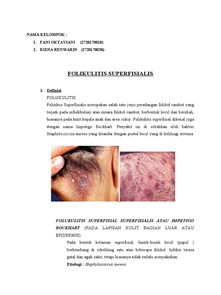 Folikulitis Superfisialis (KMB) | PDF