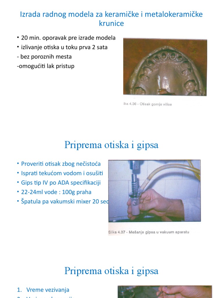 Izrada Radnog Modela Sa Pokretnim Radnim Patrljcima Za Keramičke I ...