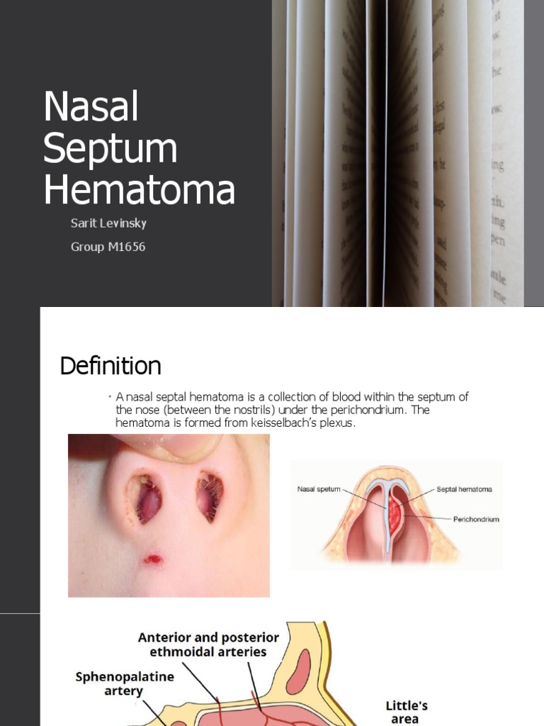 Nasal Septum Hematoma: Sarit Levinsky Group M1656 | PDF | Human Nose ...