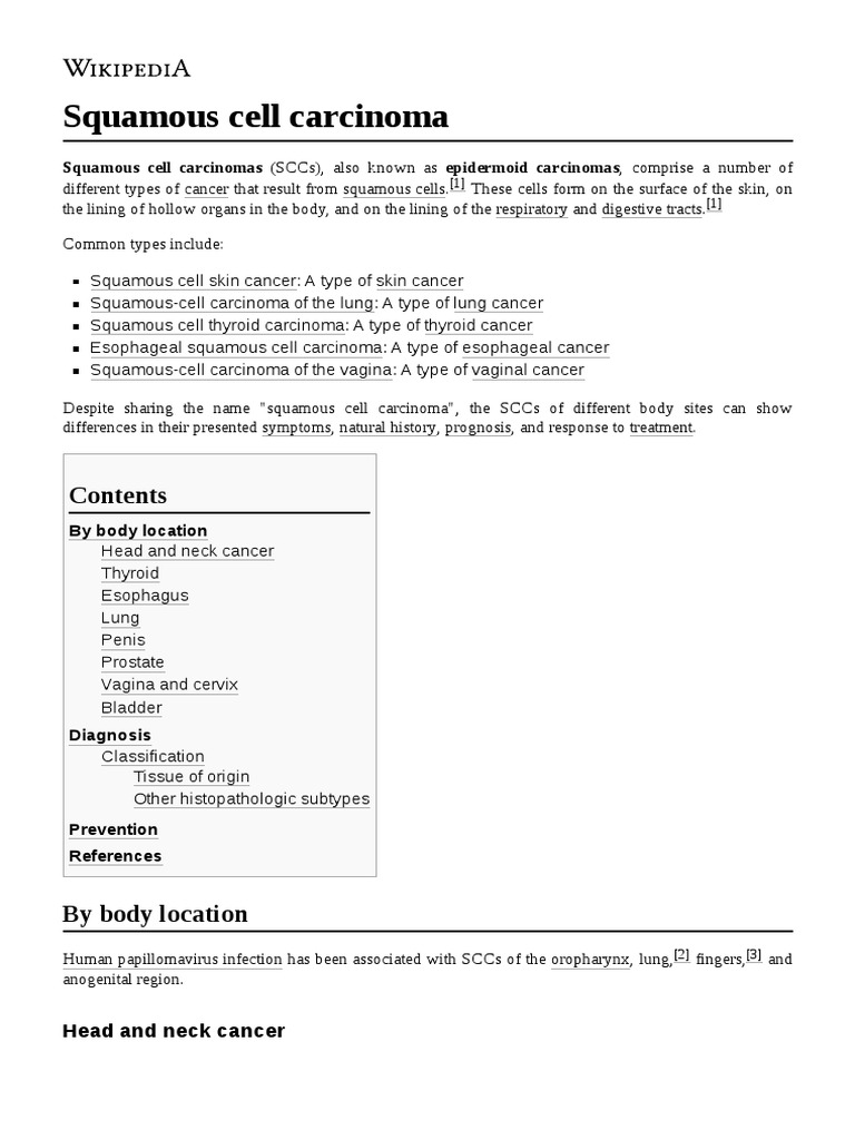 Squamous Cell Carcinoma | PDF | Biology | Neoplasms
