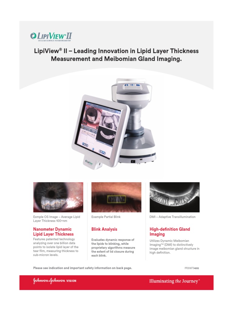 Lipiview II Fact Sheet | PDF | Contact Lens | Interferometry