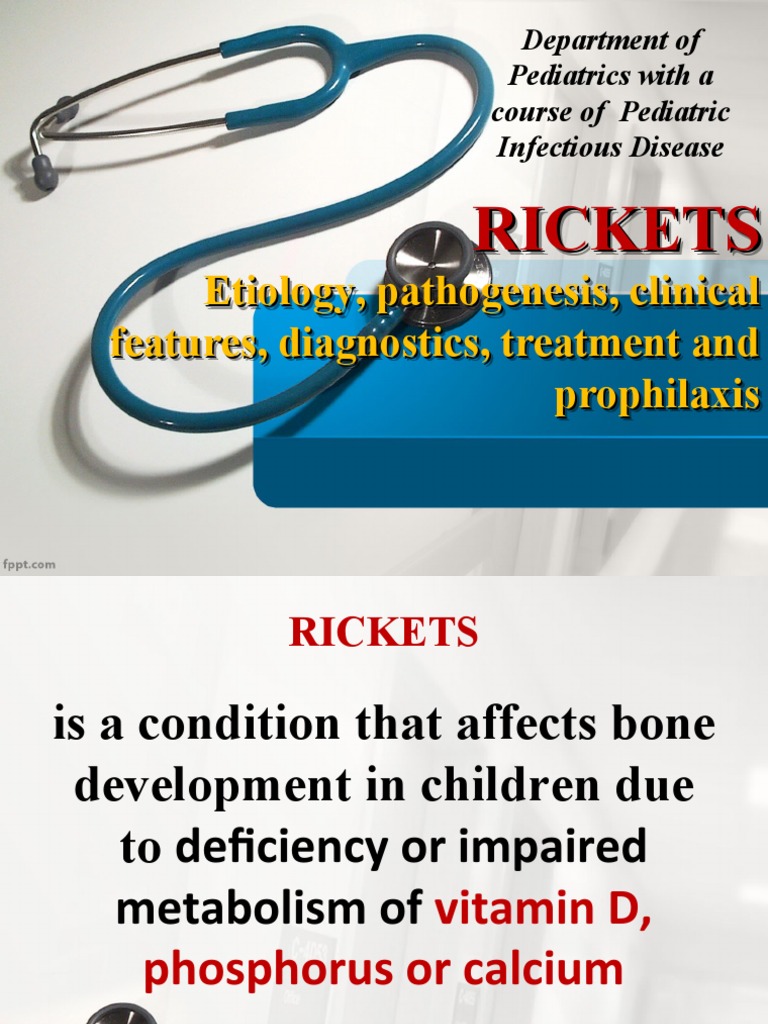 Etiology, Pathogenesis, Clinical Features, Diagnostics, Treatment and ...