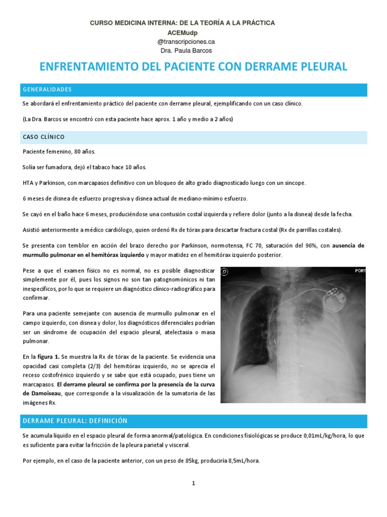 Manejo del Derrame Pleural | PDF | Tuberculosis | Edema