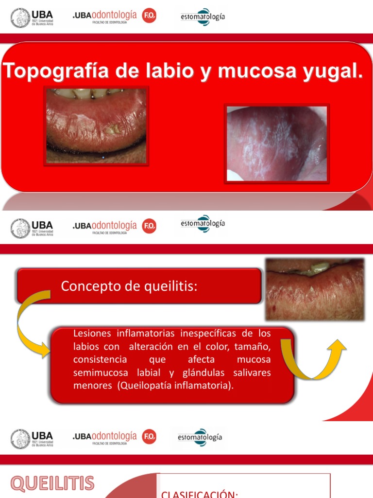 Tema 11 Topografia De Labio Y Mucosa Yugal Pdf Enfermedades Y