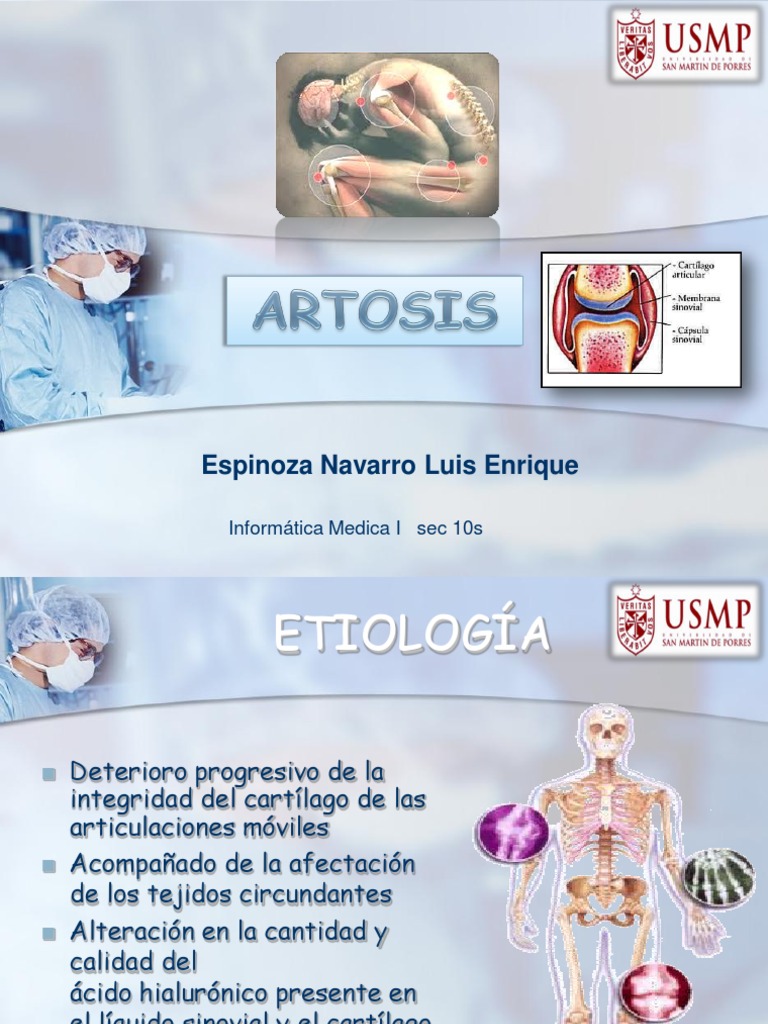 Artosis Final | Cartílago | Articulación