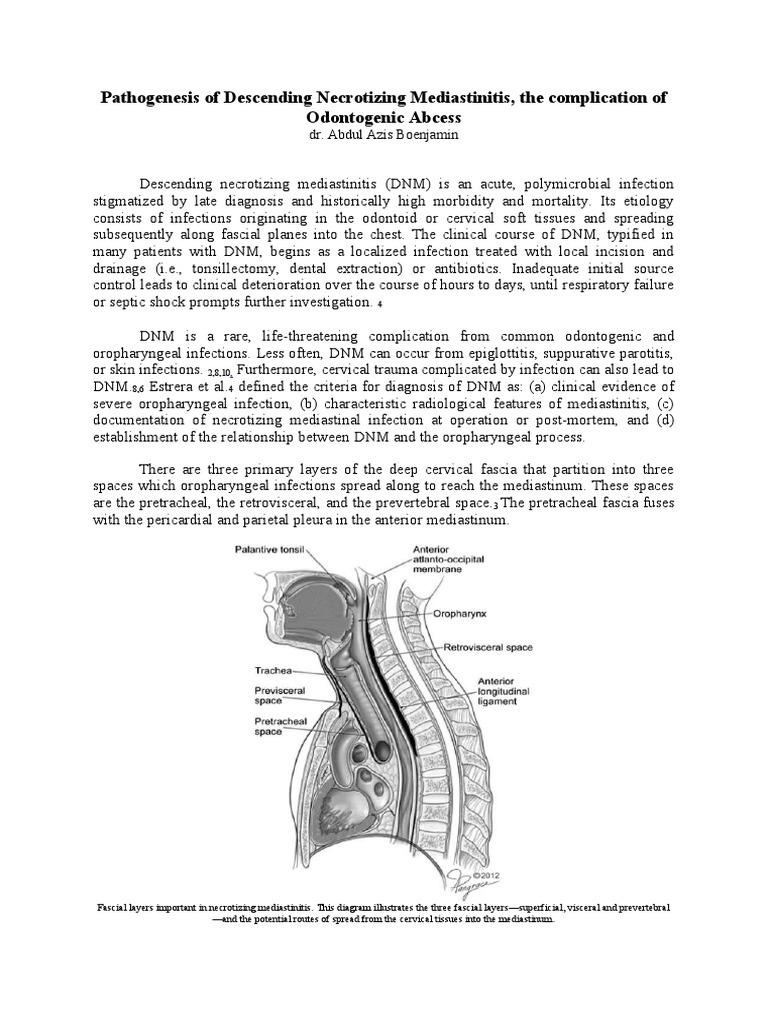 Pathogenesis of Descending Necrotizing Mediastinitis, The Complication of Odontogenic Abcess ...