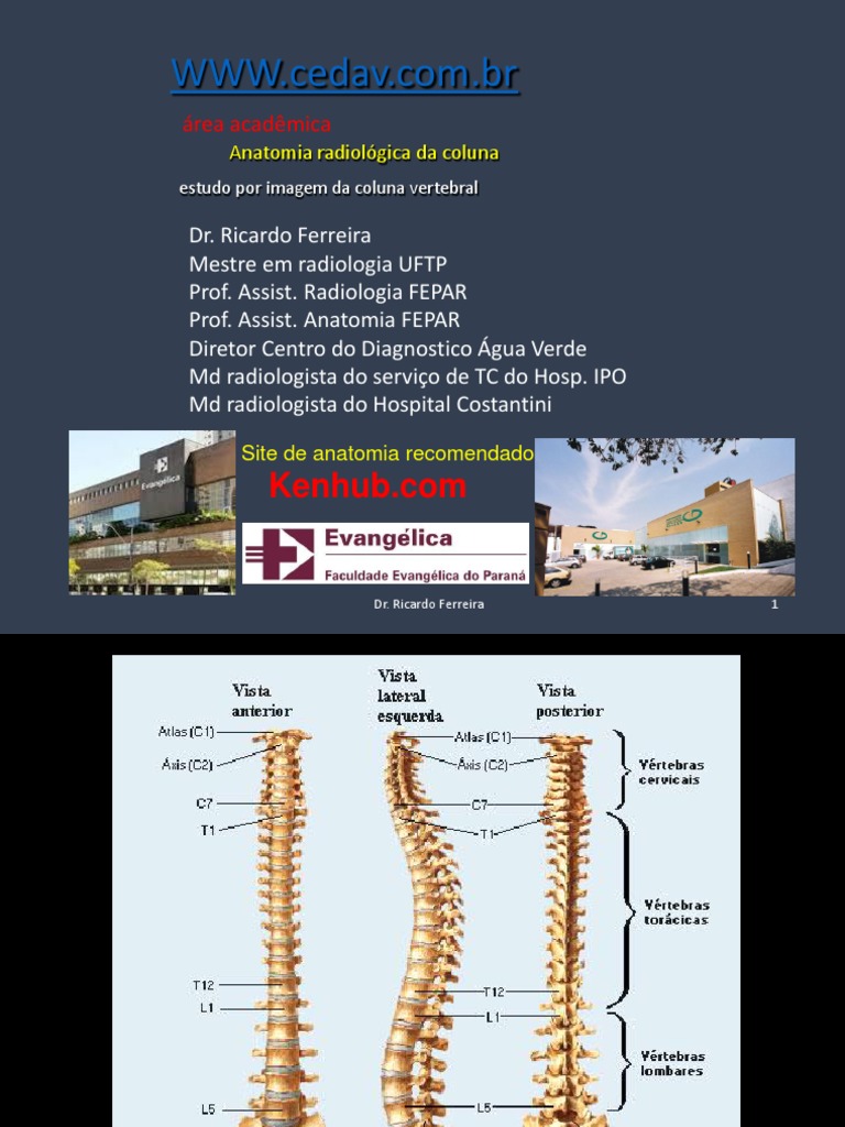 Anatomia e Imagem da Coluna Vertebral: Guia Completo | PDF | Coluna ...