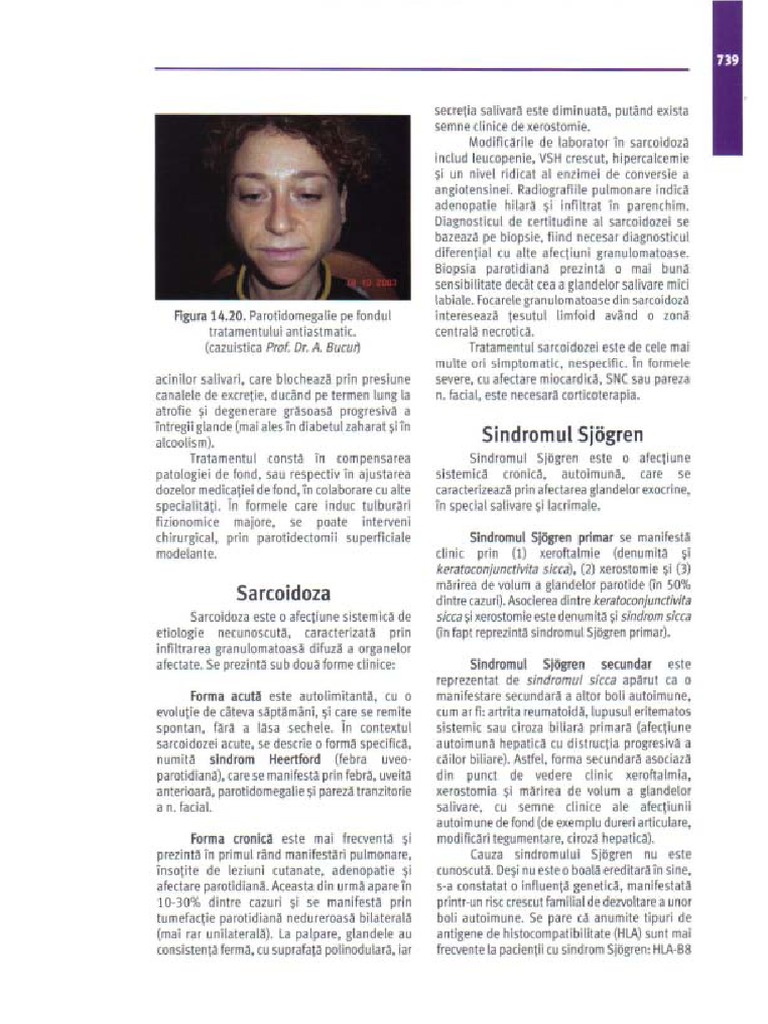 Sub 17. Sindromul Sjogren | PDF