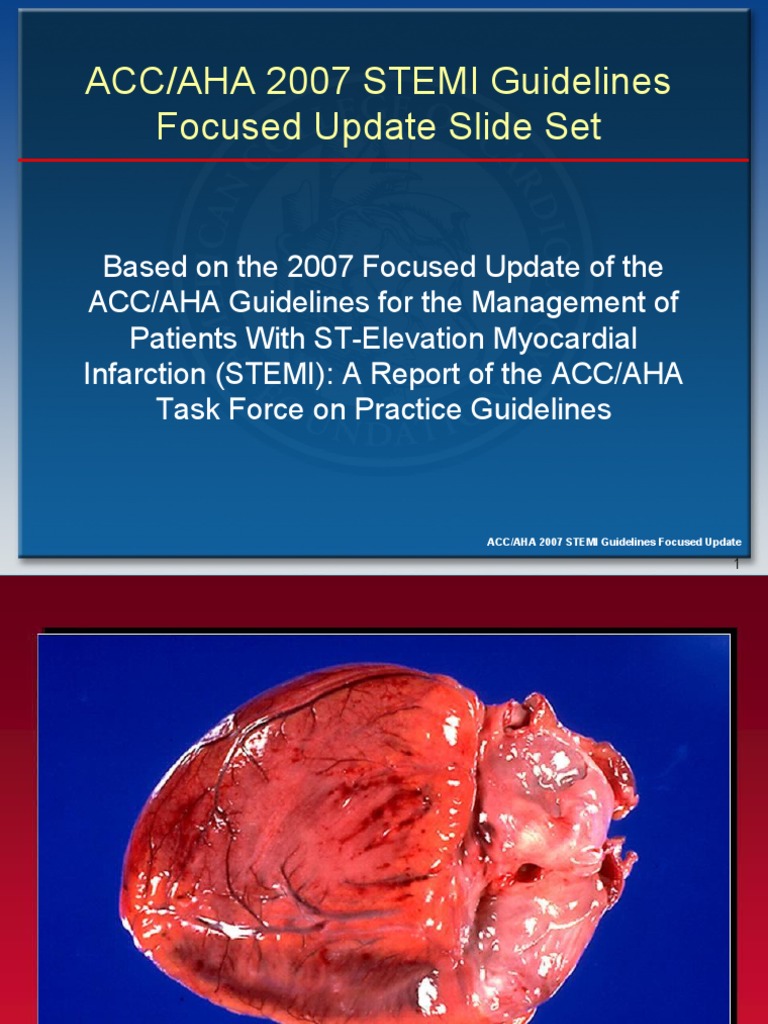 ACC/AHA 2007 STEMI Guidelines Focused Update Slide Set | PDF ...