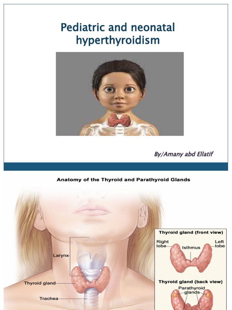 Pediatric and Neonatal Hyperthyroidism | PDF | Hyperthyroidism | Thyroid