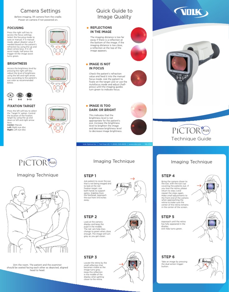 Pictor Plus - Technique Guide | PDF | Eye | Retina