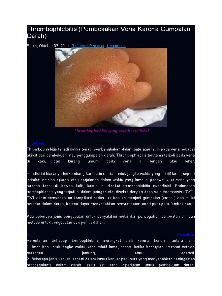 Thrombophlebitis | PDF | Sains & Matematika