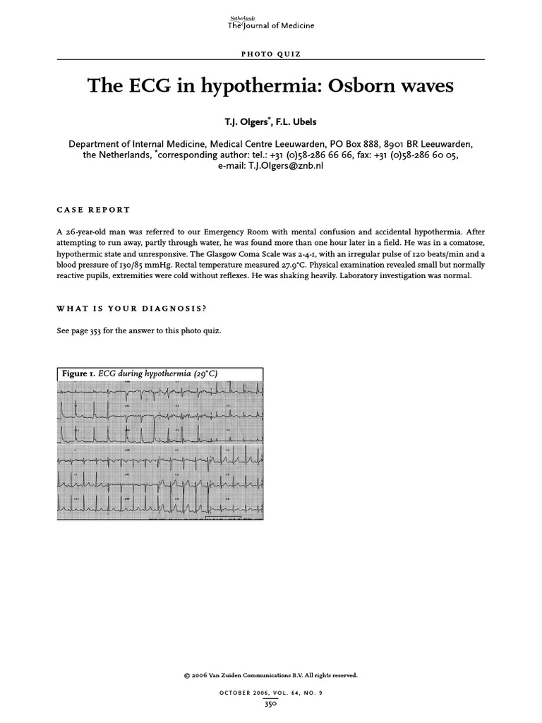 The ECG in Hypothermia - Osborn Waves | PDF | Hypothermia ...