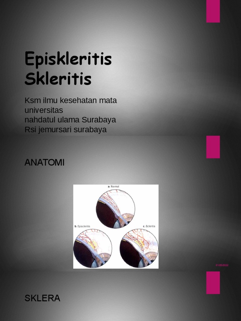 Episklera, Sklera | PDF