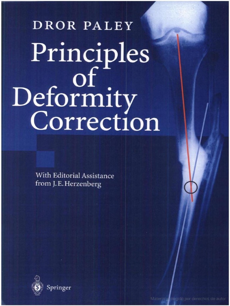 Principles of Deformity Correction | PDF
