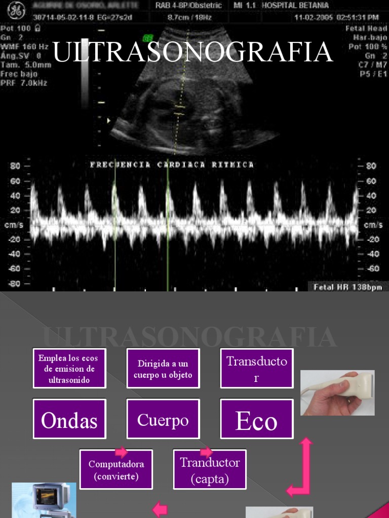 Ultrasonografia | PDF | Ultrasonido médico | Ultrasonido