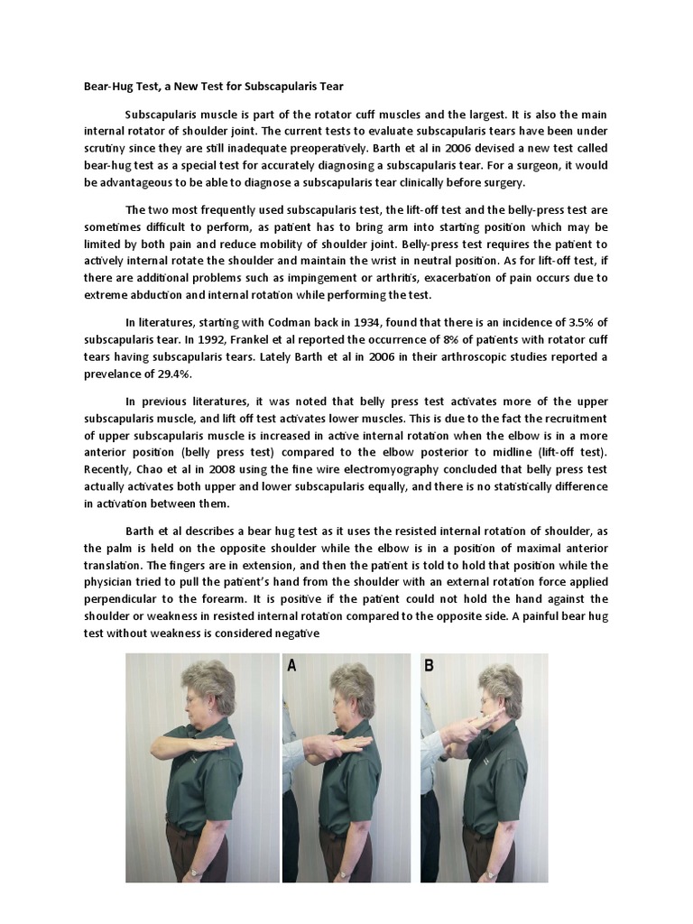 Bear-Hug Test for Subscapularis Tears | PDF | Shoulder | Sensitivity ...