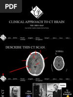 Reading Normal Head CT Scans | PDF | Ct Scan | Parietal Lobe