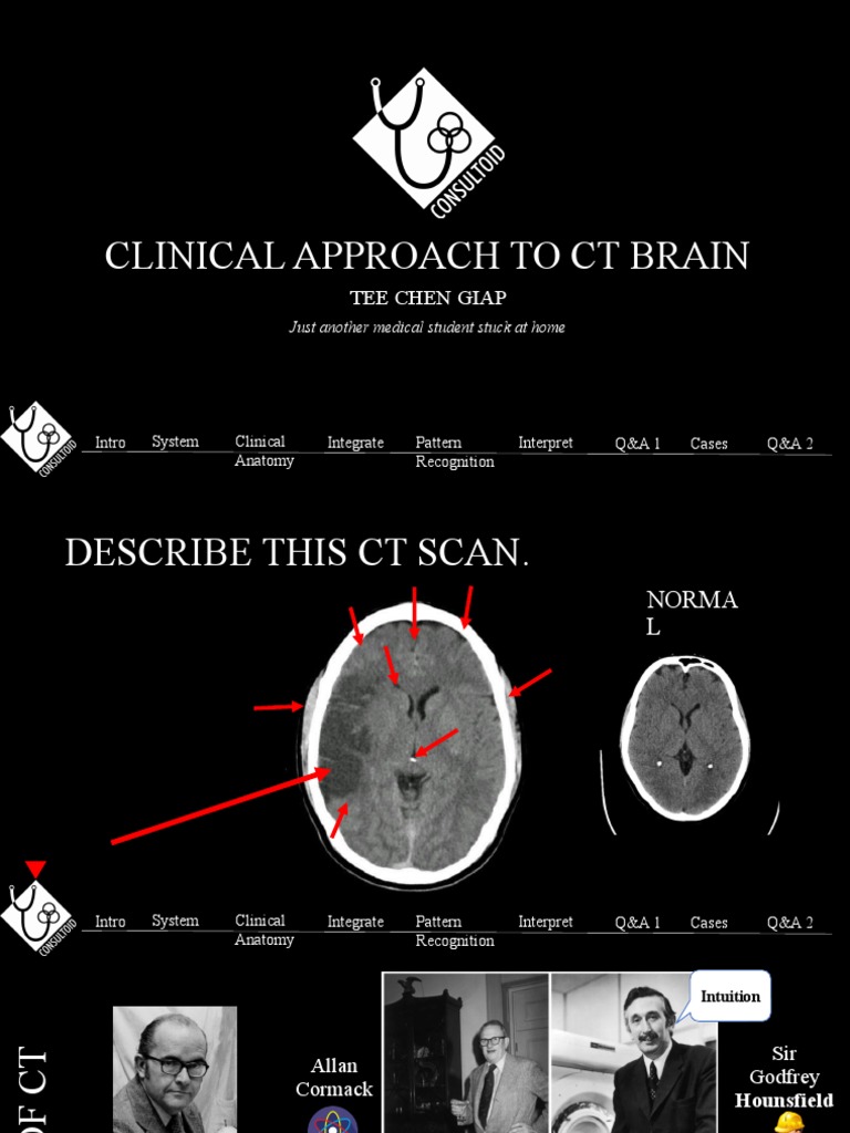 Clinical Approach To CT Brain | PDF | Ct Scan | Diseases And Disorders