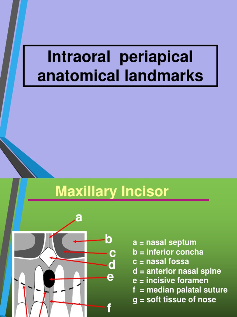 Intraoral Periapical Anatomy | PDF | Human Nose | Dental Anatomy