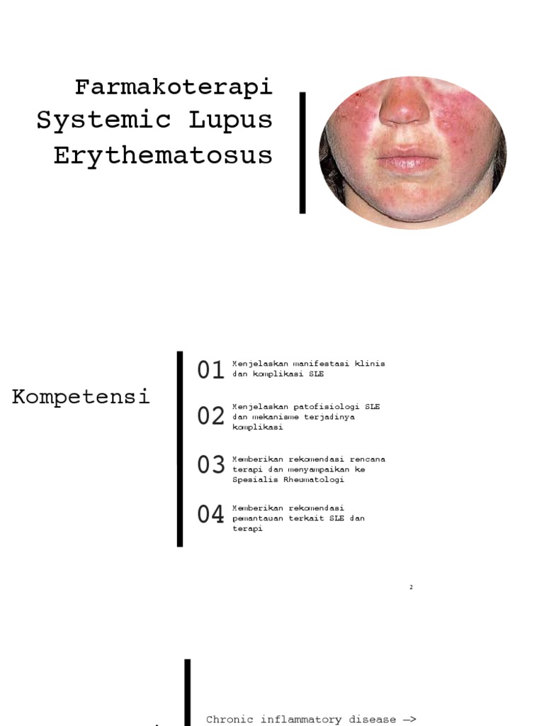 Farmakoterapi - SLE | PDF | Immune System | Medicine