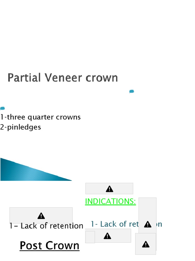 1-Three Quarter Crowns 2-Pinledges | PDF