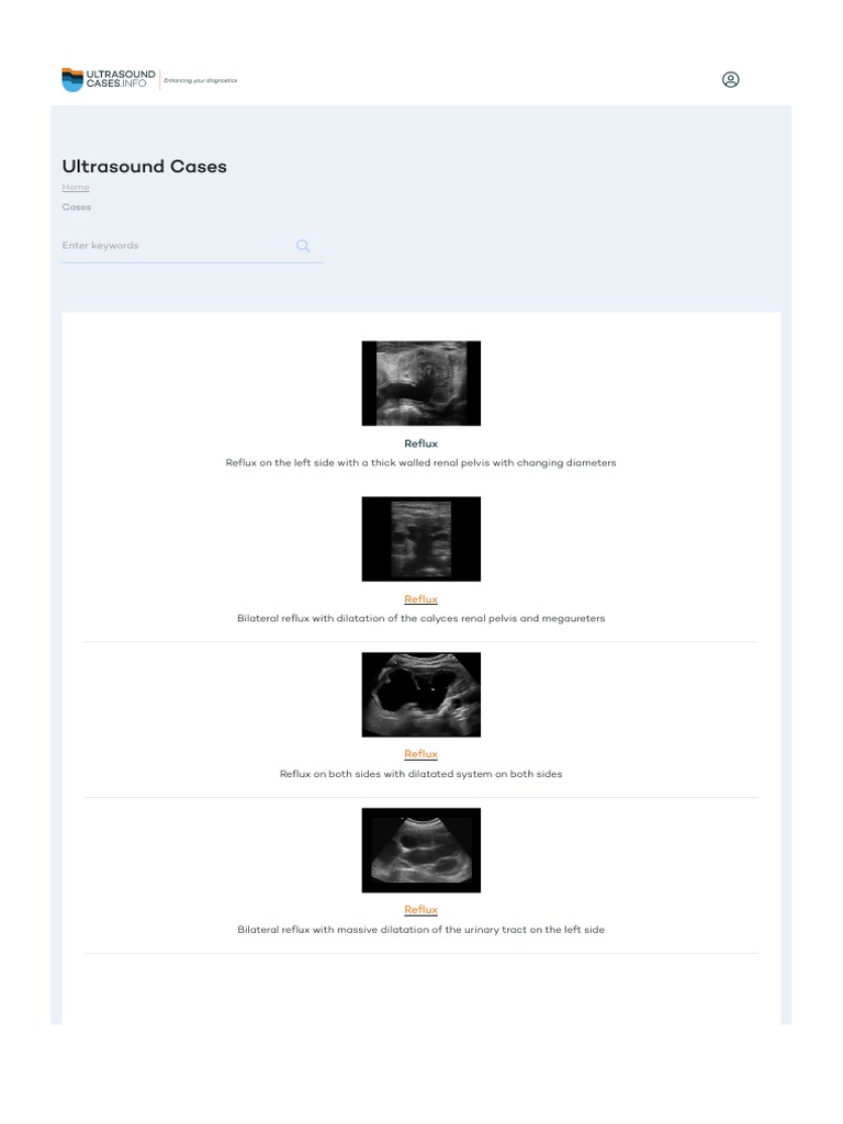 Reflux - Ultrasound Cases | PDF | Urinary System | Anatomy