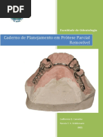 PDF Cartilha Grampos PPR | PDF | Dente | Prótese