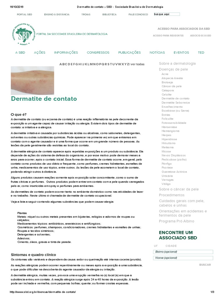 Dermatite de Contato SBD - Sociedade Brasileira de Dermatologia | PDF | Dermatite | Alergia