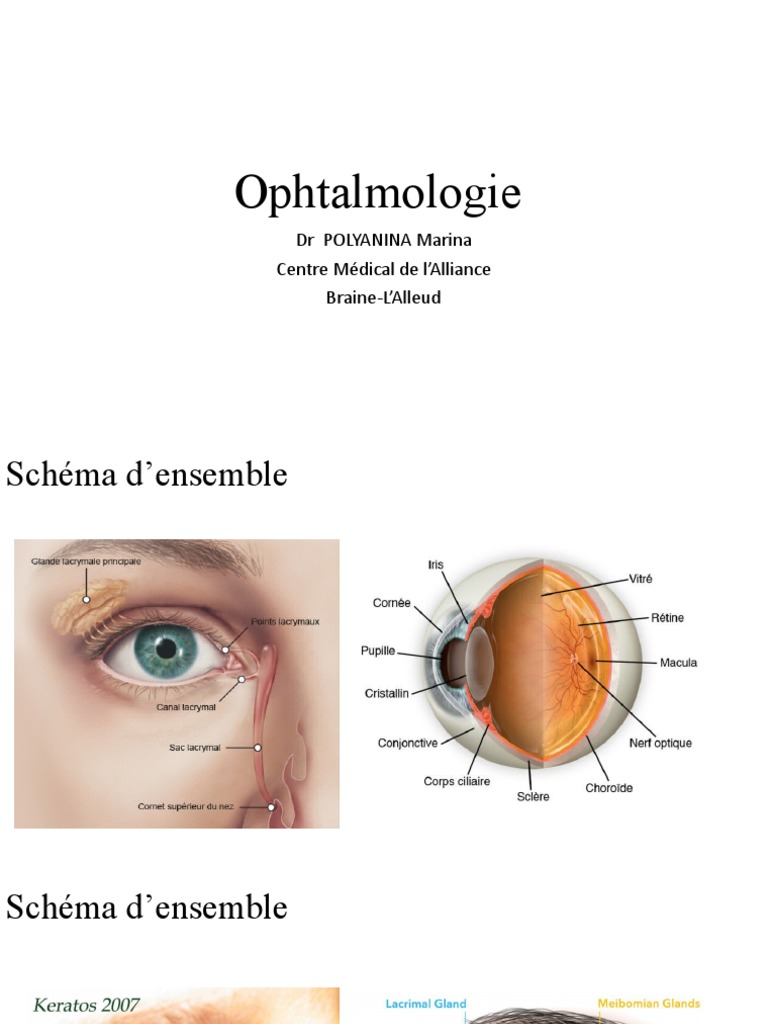 Schéma de la cataracte et chirurgie ophtalmique | PDF | Cataracte ...