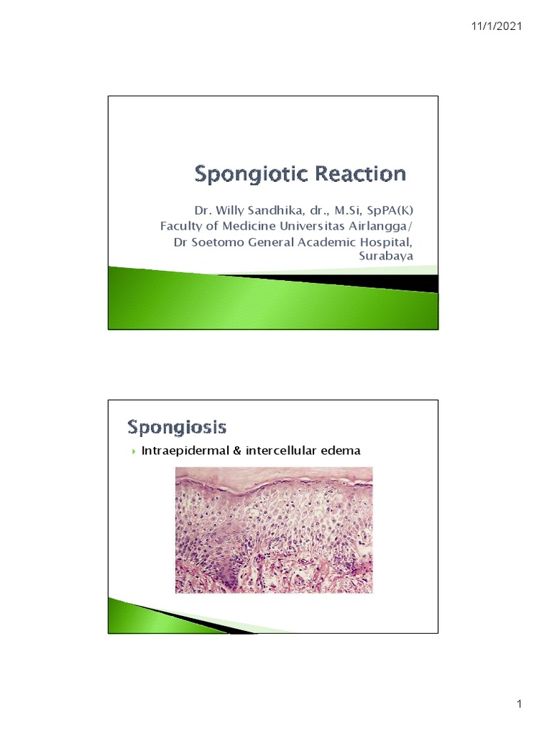 Spongiotic Reaction | PDF | Dermatitis | Epidermis