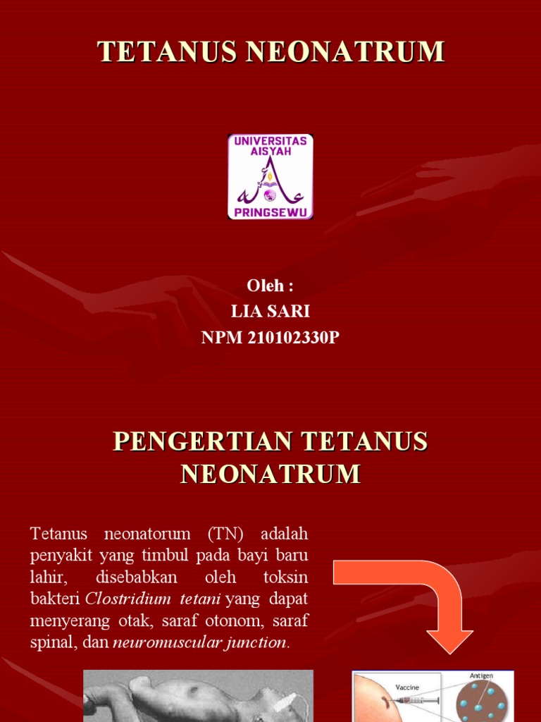Tetanus Neonatorum: Penyebab dan Penanganan | PDF