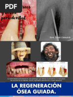 Defectos Óseos | PDF | Hueso | Especialidades Medicas