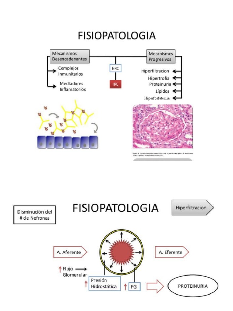 Fisiopatologia de ERC | PDF