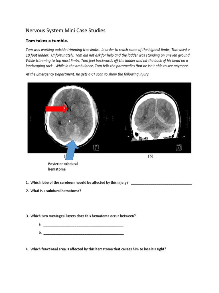 Nervous System Mini Case Studies 2 | PDF