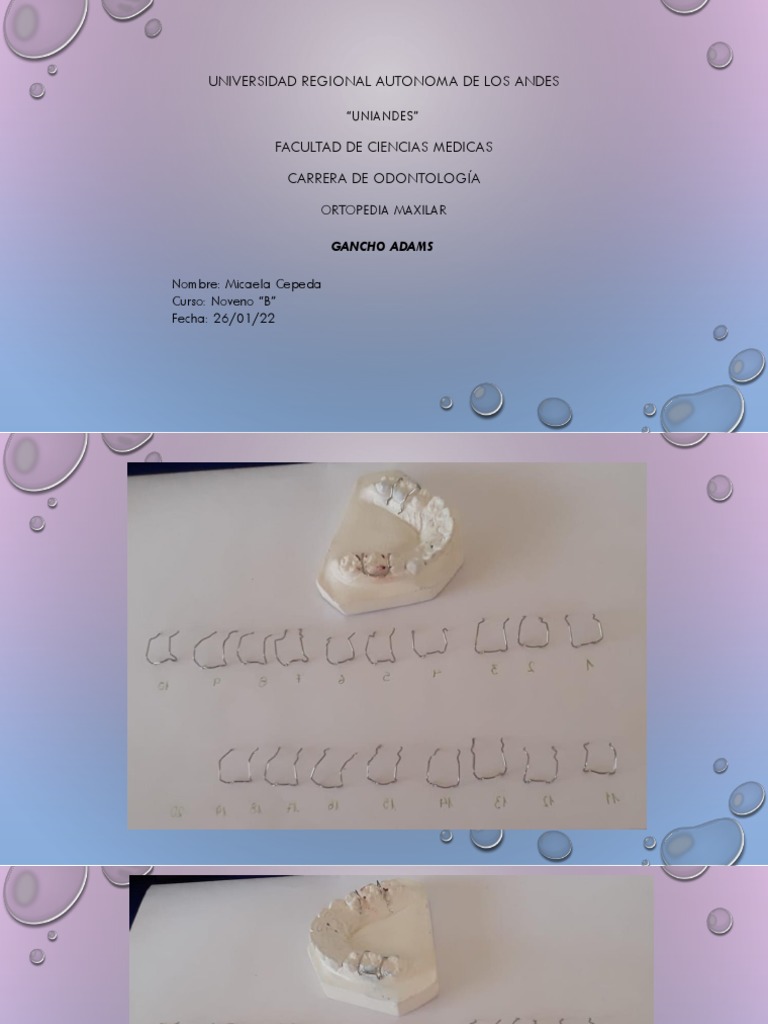 Gancho Adams en Ortodoncia | PDF | Relaciones personales, crianza y ...