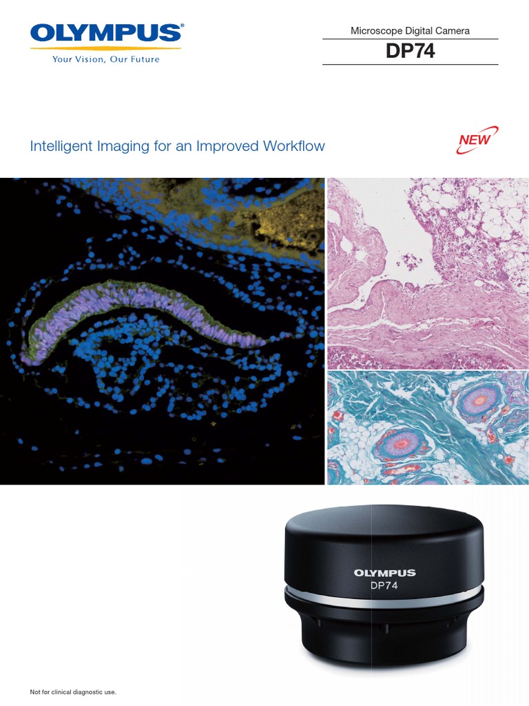 Intelligent Imaging For An Improved Workflow: Microscope Digital Camera ...