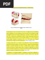 Activador Abierto de Klammt | PDF | Ortodoncia | Boca