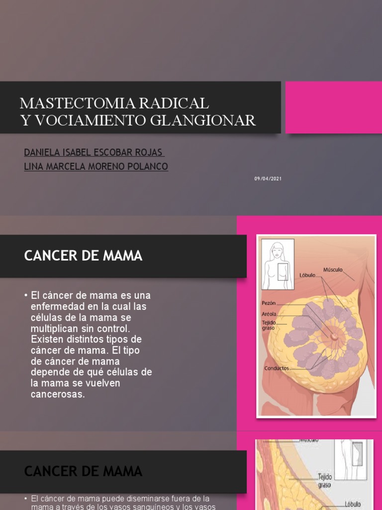 Mastectomia Radical y Vaciamiento Glanglionar | PDF | Cáncer de mama ...