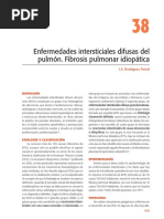 Enfermedad Pulmonar Intersticial Difusa (EPID) .PPTX Versión 1 | PDF | Inflamación | Nicotina